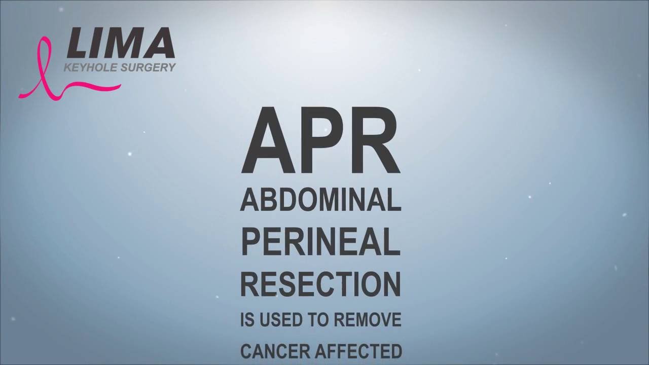 Abdominal Perineal Resection - Dr J S Rajkumar - LIMA Lifeline ...