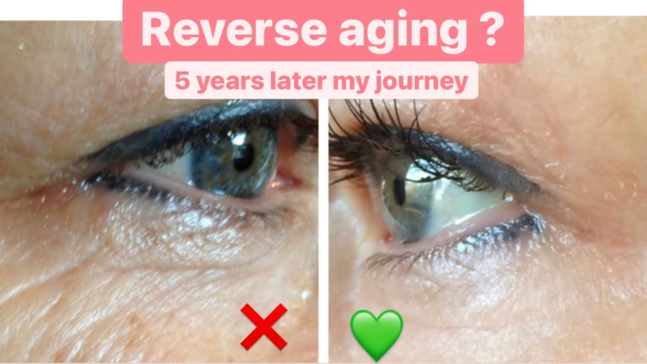 REVERSE AGING WHAT I'M DOING??? MY 5 YEAR JOURNEY Q&A TURNING 60 ...