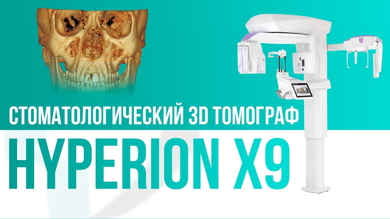 Стоматологический 3D томограф Hyperion X9 - YouTube