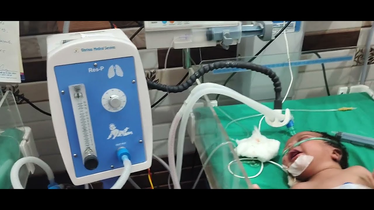 New born baby is very beautiful videos in hospital || C PAP Baby Vairal ...