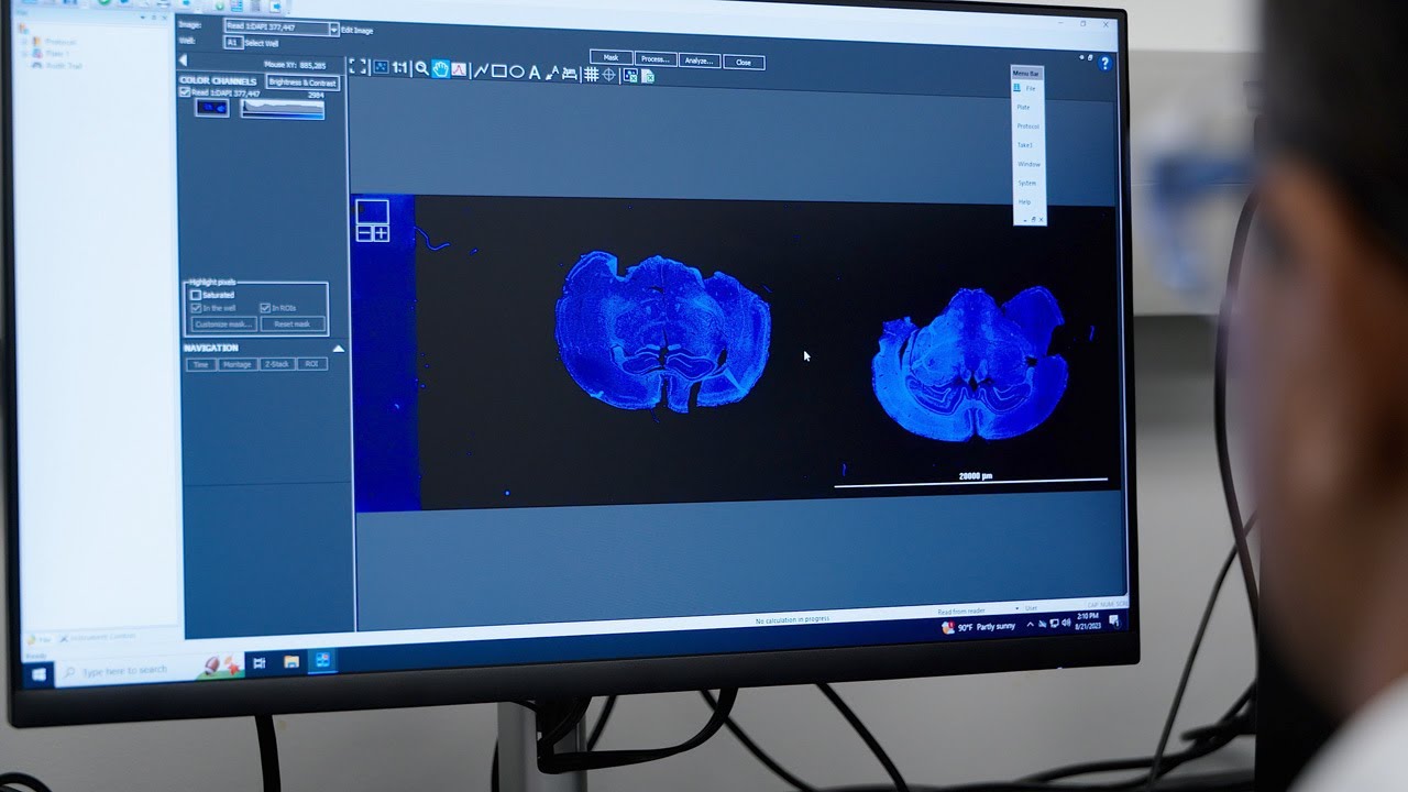 NIH awards $10.6 million for Central Nervous System Metabolism Research ...