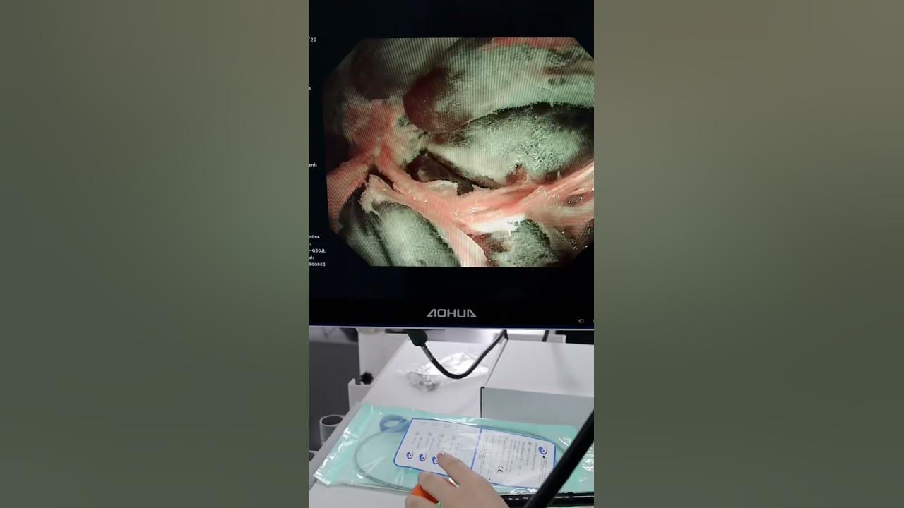Видео эндоскопия от производителя AOHUA. - YouTube