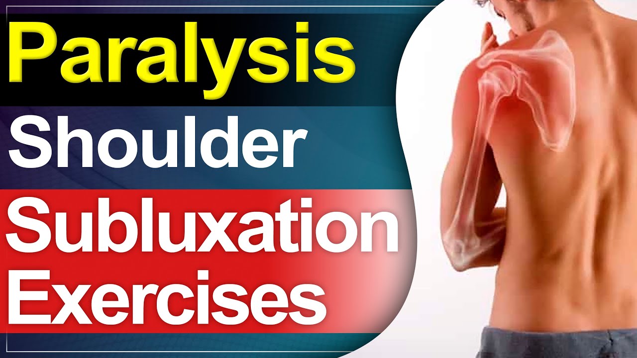 Paralysis Shoulder Subluxation Exercises | Shoulder Exercises in ...