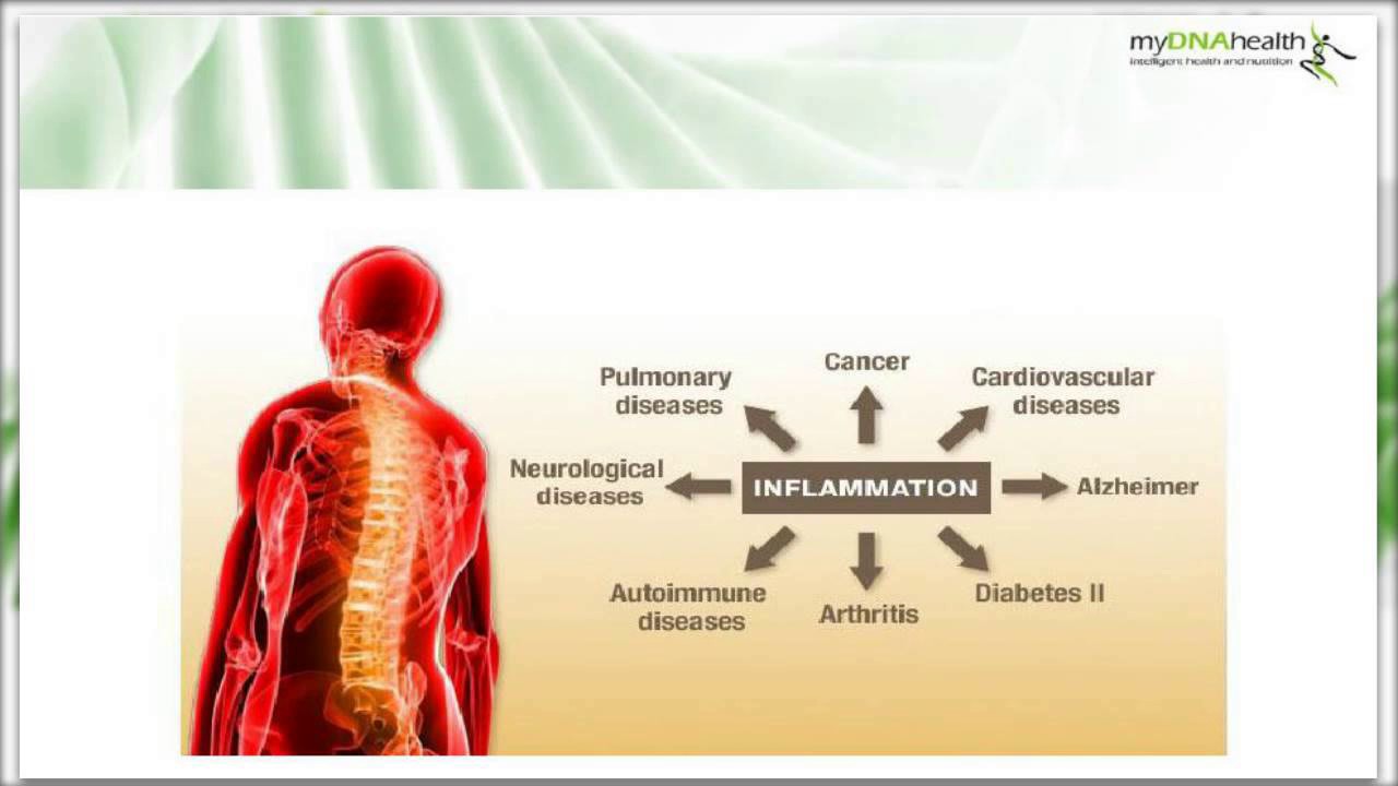 Inflammation: The Role of Epigenetics and Gene Expression - YouTube