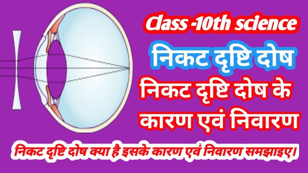 निकट दृष्टि दोष कक्षा 10 | nikat drishti dosh class 10 | near/short ...