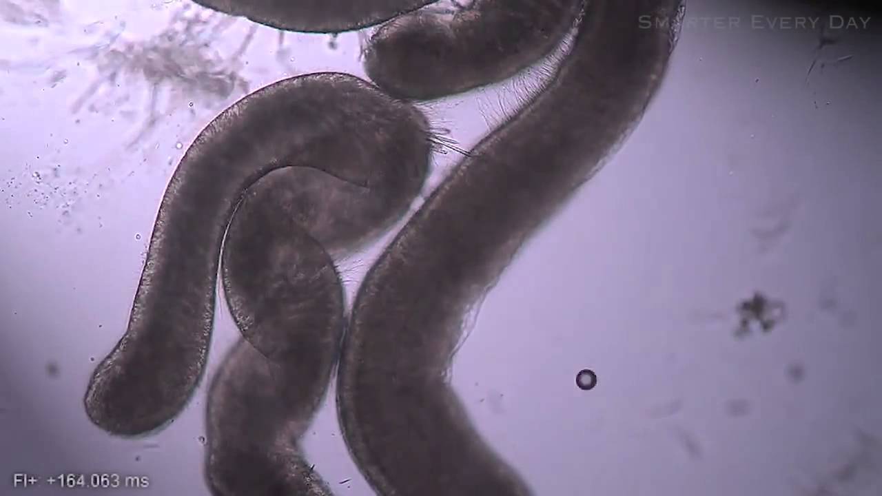 Jellyfish Stinging in MICROSCOPIC SLOW MOTION Smarter Every Day 120 ...