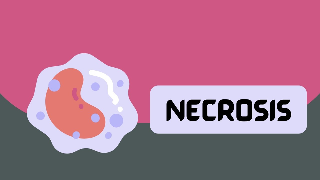 what is NECROSIS ? | definition of NECROSIS | cell injury - YouTube