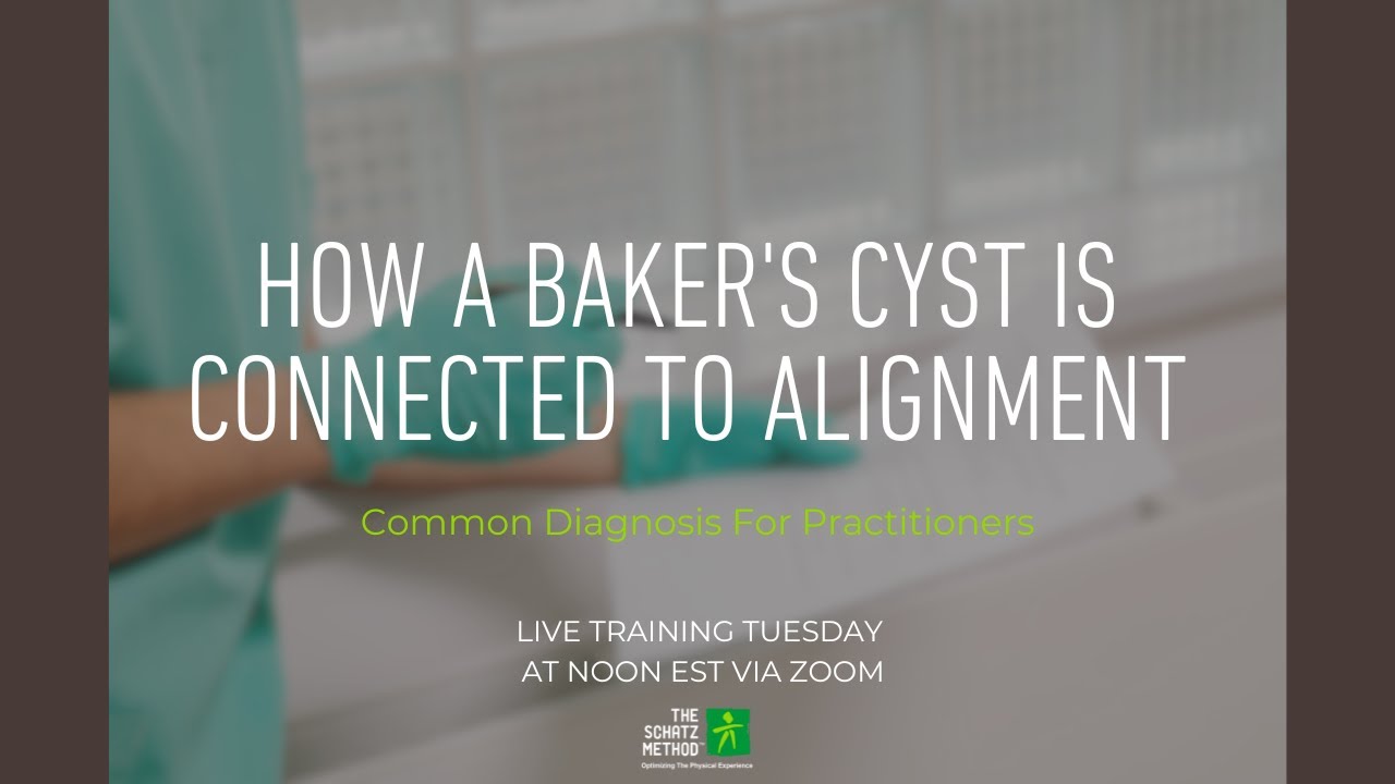 How a baker's cyst is connected to alignment - LIVE Practitioner ...
