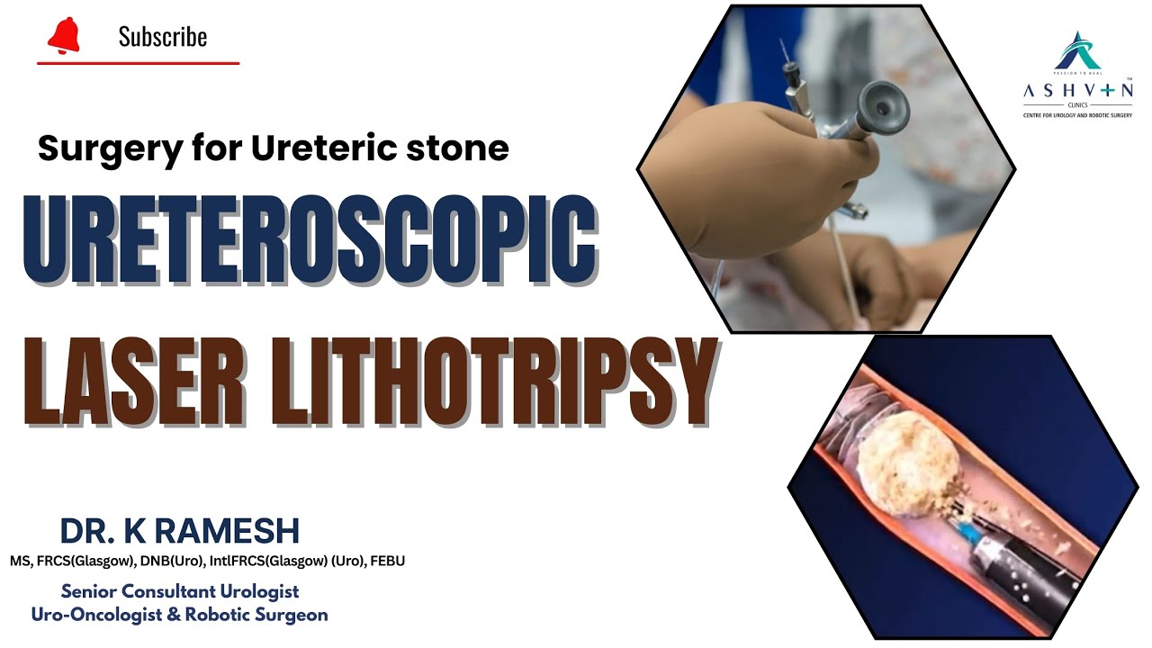 Ureteroscopic Laser Lithotripsy (URSL) | Dr. K Ramesh Urologist, Uro-oncologist & Robotic ...