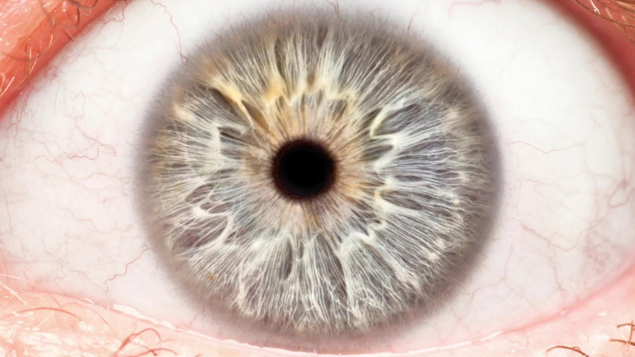 Iris Chart On This Beautiful Left Iris - YouTube
