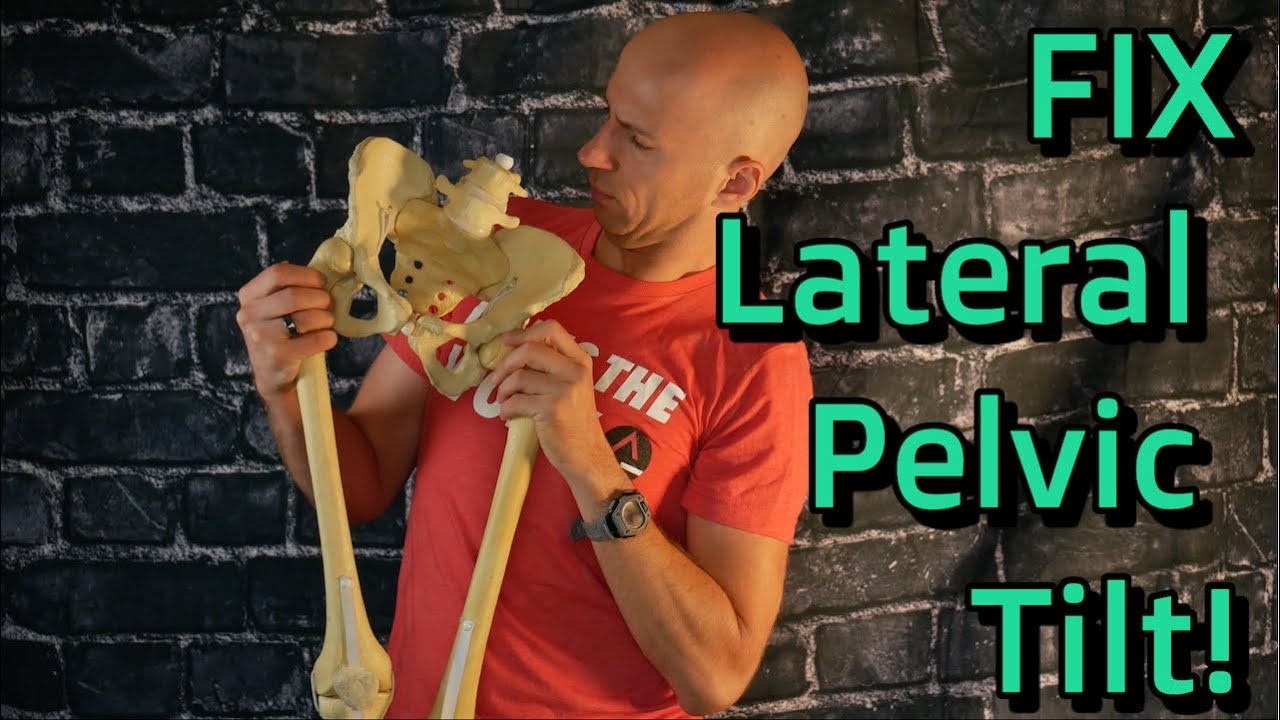 Lateral Pelvic Tilt Correction Exercises - Why It Happens and What YOU ...