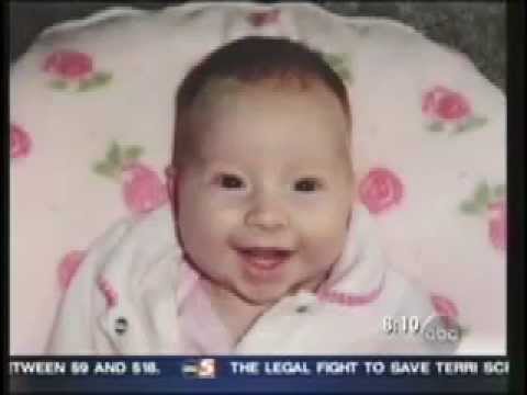 The Miracle Story of Lilly ( ECMO ) - YouTube