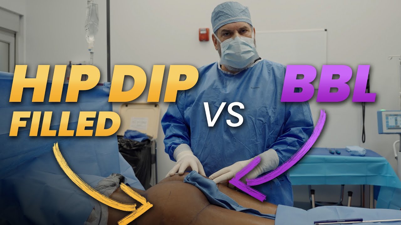 Filling Hip Dips: What to Expect from a BBL Procedure - YouTube