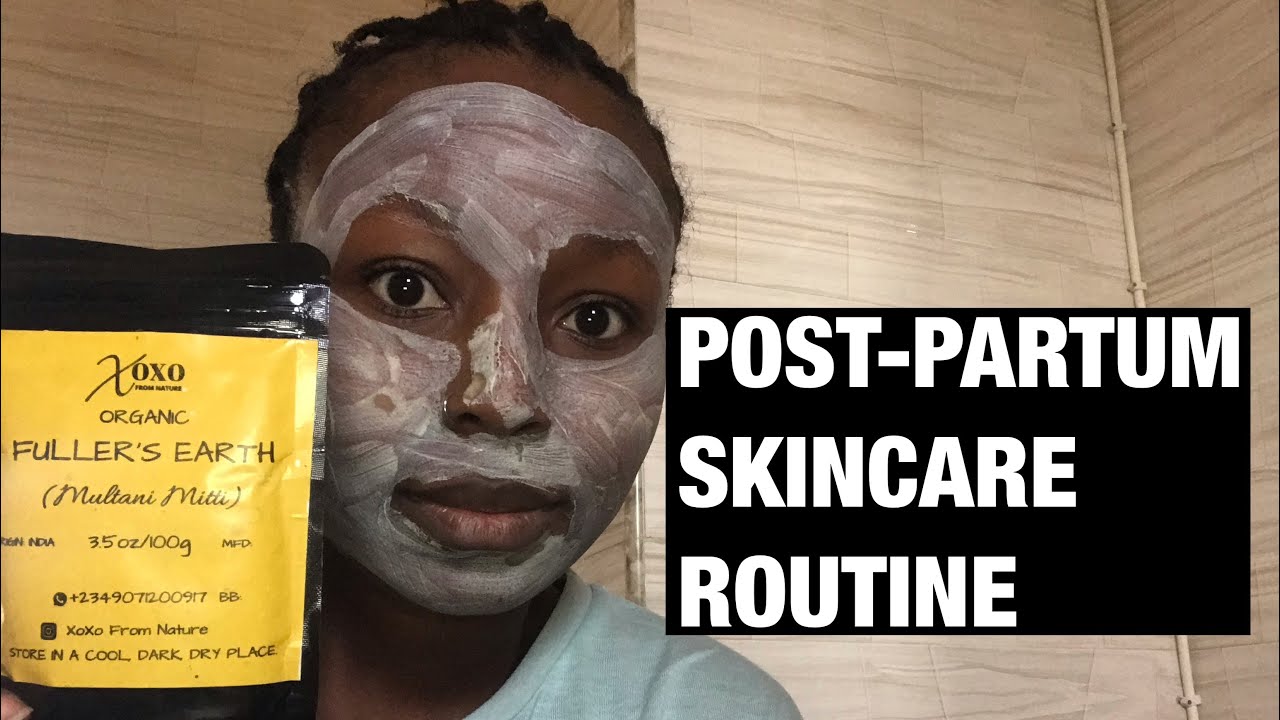 Postpartum Skin care routine | Hyperpigmentation | LAGOS LIVING 21 ...