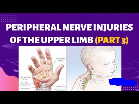 peripheral nerve injuries of the upper limb part 3 | TOS & stringer ...