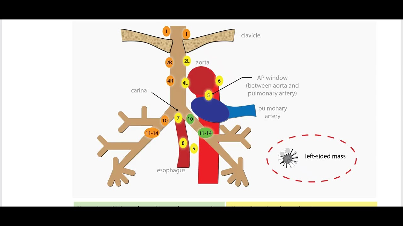 Chest radiology visuals from core radiology ㅣradiopaedia @ctisus ...