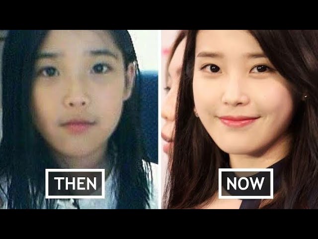 Iu Plastic Surgery Before And After