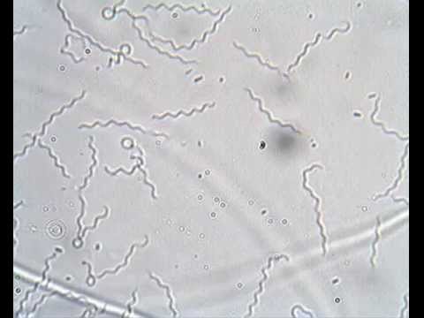 Spirochaeta in Activated Sludge 2 - YouTube