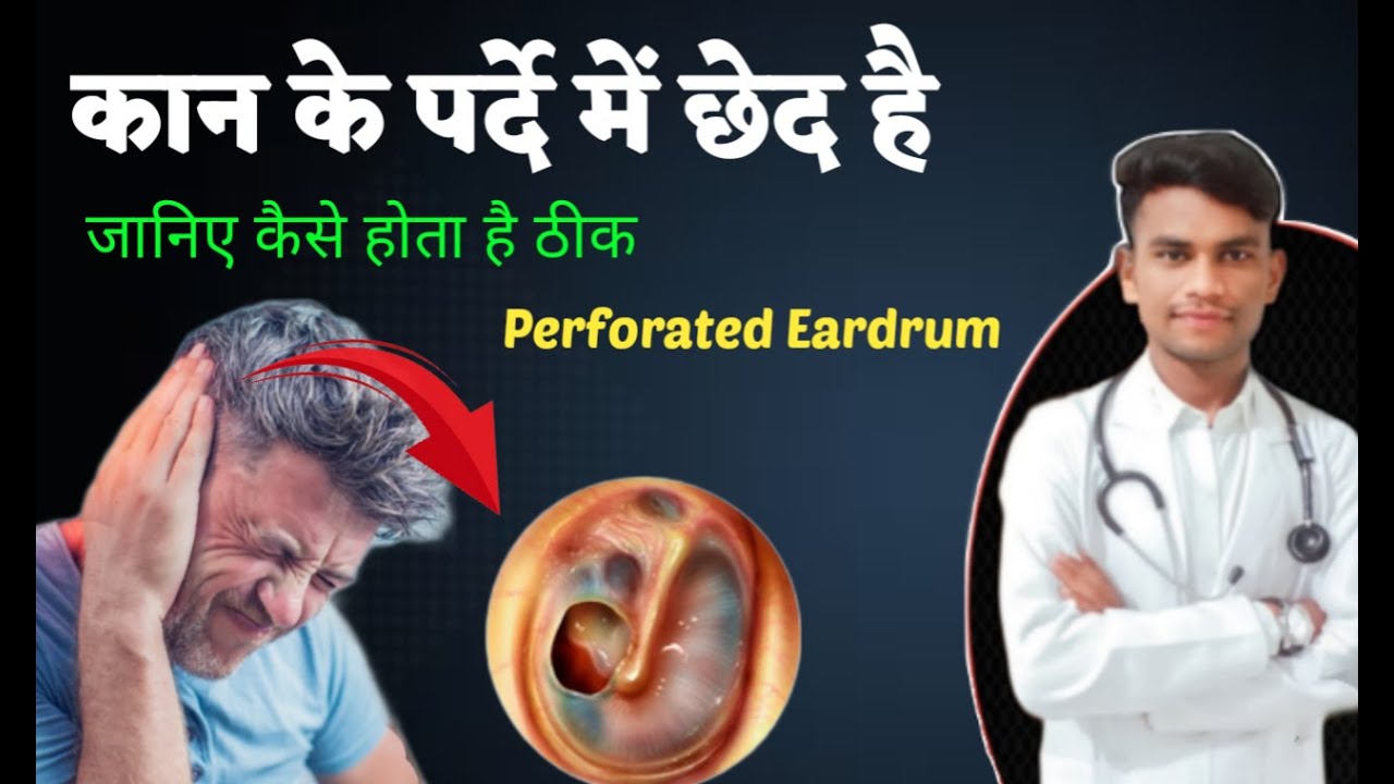 कान के पर्दे में छेद, Perforated Eardrum, Causes, Symptoms, Diagnosis ...