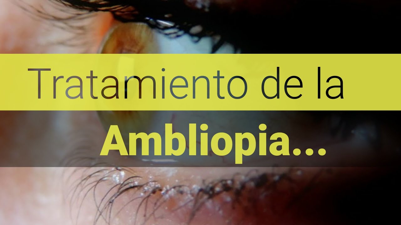 Que es la AMBLIOPIA u OJO PEREZOSO, causas, detección y tratamiento ...