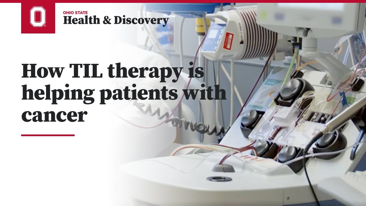 How TIL therapy is helping patients with cancer | Ohio State Medical ...