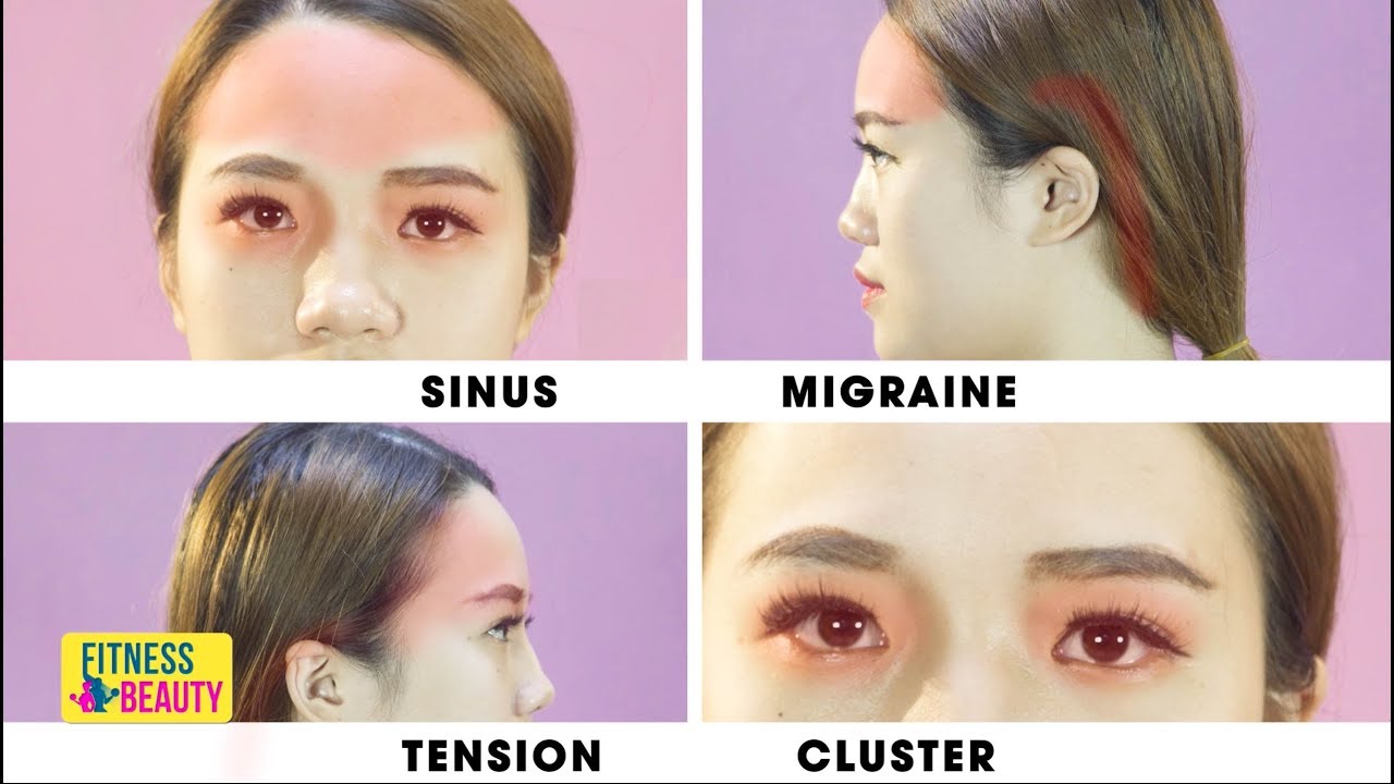 How to use acupressure points for headaches ? - YouTube