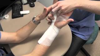 Ulnar Gutter Cast