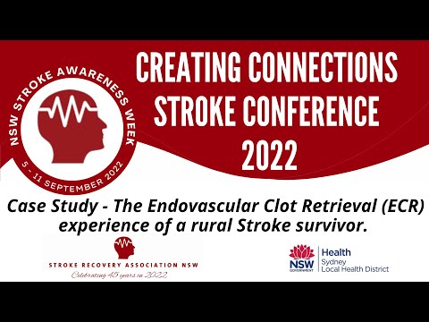 "The Endovascular Clot Retrieval (ECR) experience of a rural Stroke ...