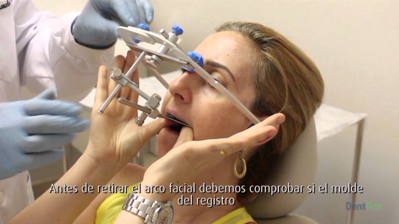 Registro con arco facial y montaje con Articulador 12000 Plus Dentflex ...