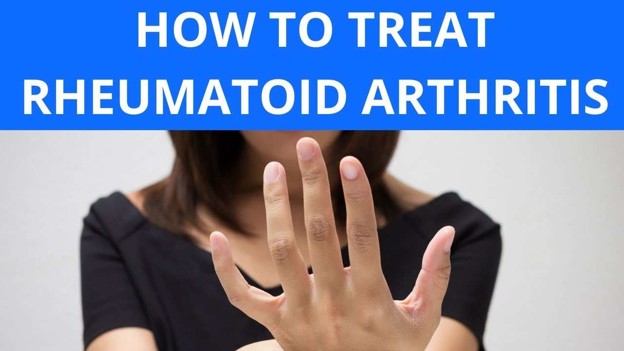 How To Treat Rheumatoid Arthritis - YouTube