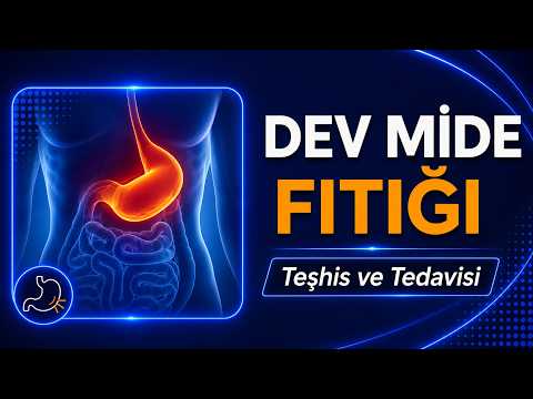 DEV MİDE FITIĞI TEŞHİS VE TEDAVİSİ