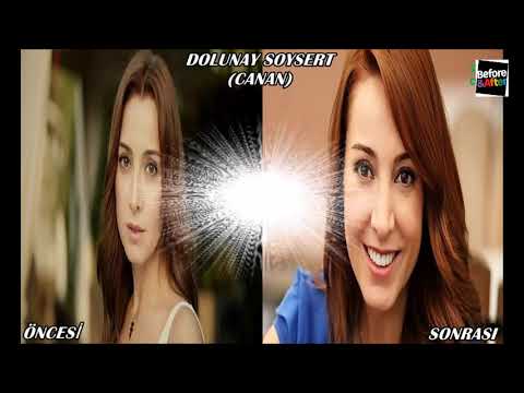 Bana Sevmeyi Anlat   Before and After 2017