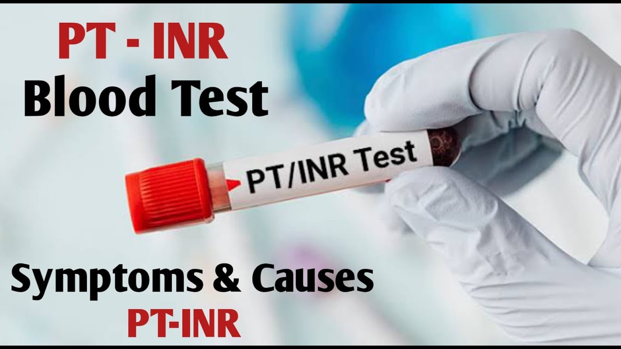 what is pt inr test I High causes of pt test I Symptoms of high pt inr ...