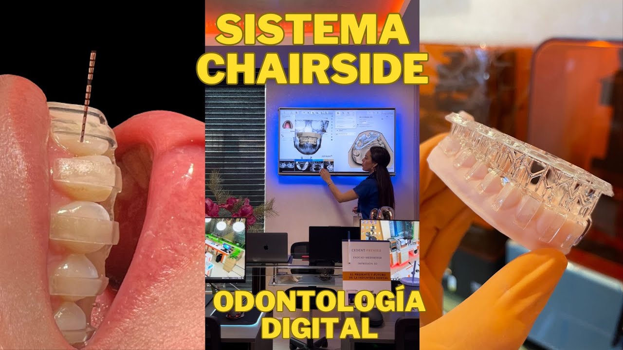 SISTEMA CHAIRSIDE-ODONTOLOGÍA DIGITAL - YouTube