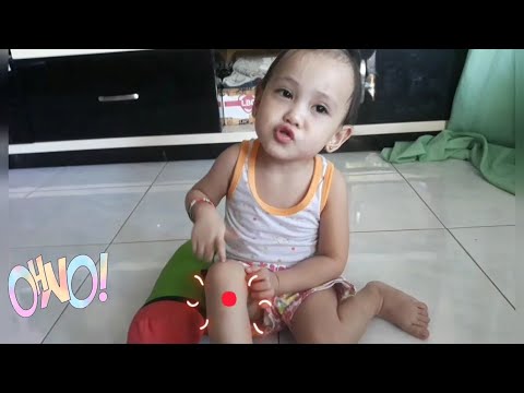 The Boo Boo Story from Leanne , Nalla, Xandra and Eunice - YouTube