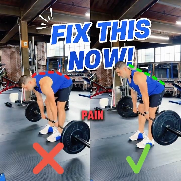 Stop doing RDLs like this before you wreck your lower back! - YouTube