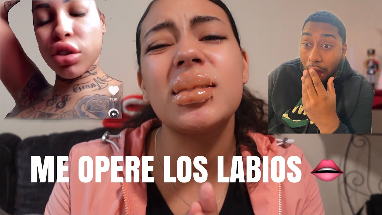 BROMA AMI NOVIO / ME OPERÉ LOS LABIOS 👄🤣 - YouTube