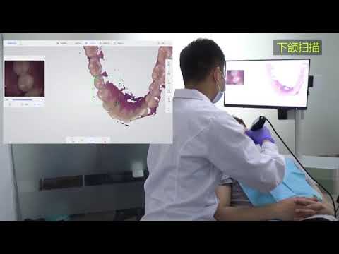 PANDA P2 Intraoral Scanner | Clinic Scanning Demonstration - YouTube