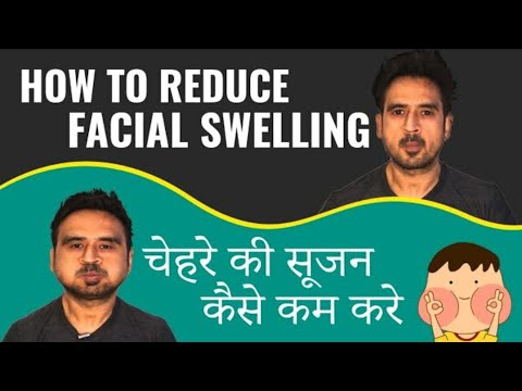 चेहरे की सूजन कैसे कम करें|how to reduce facial bloating|reduce face ...