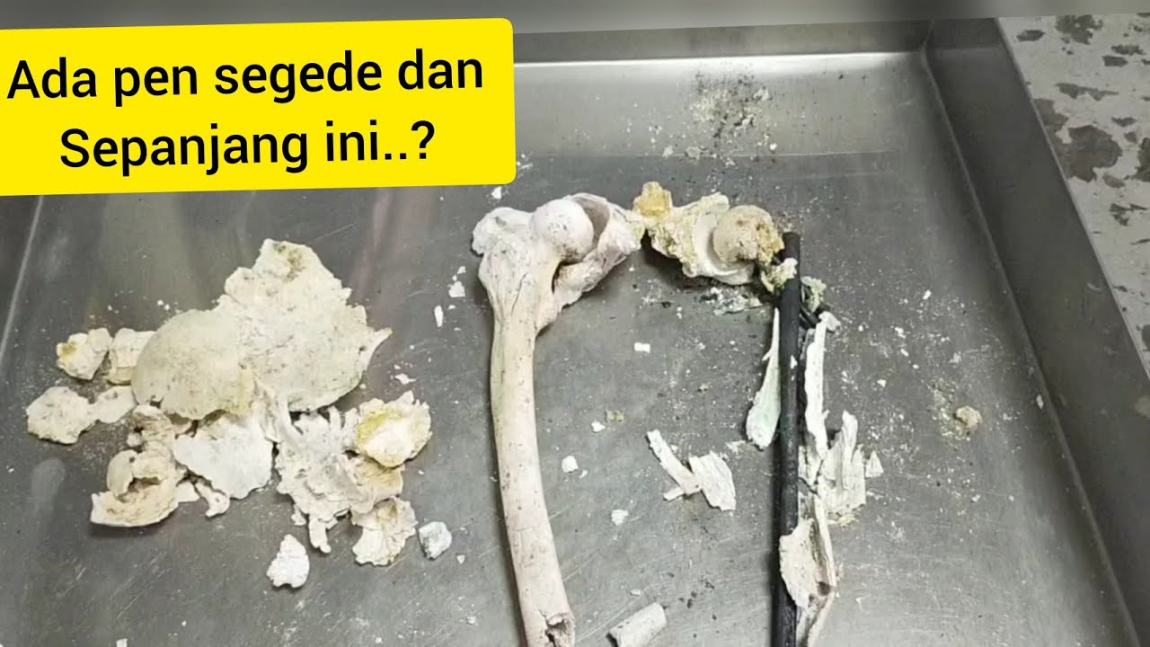 PROSES KREMASI || PEN TULANG PAHA !!! - YouTube