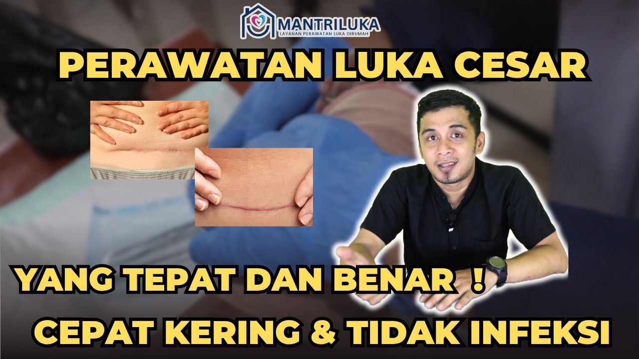 CARA PERAWATAN LUKA CESAR YANG TEPAT DAN BENAR ️CEPAT KERING DAN TIDAK ...