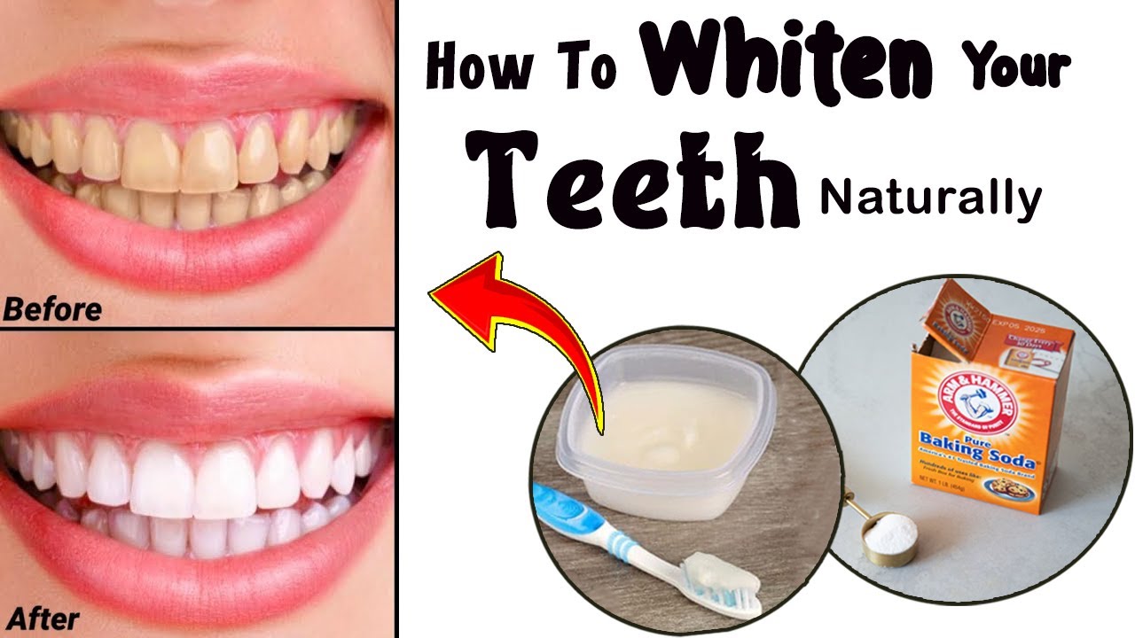 Whiten Teeth Instantly with This Simple Home Remedy! - YouTube