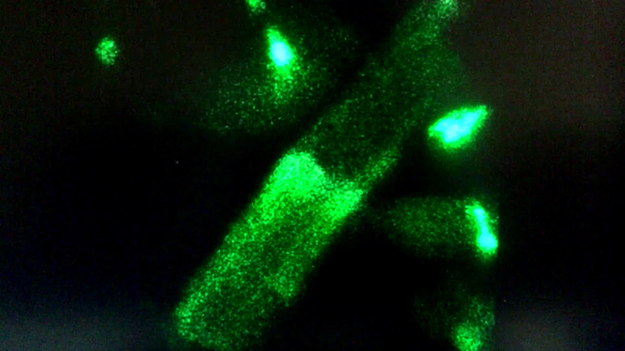 Solitons, calcium waves in isolated rat cardiomyocyte - YouTube