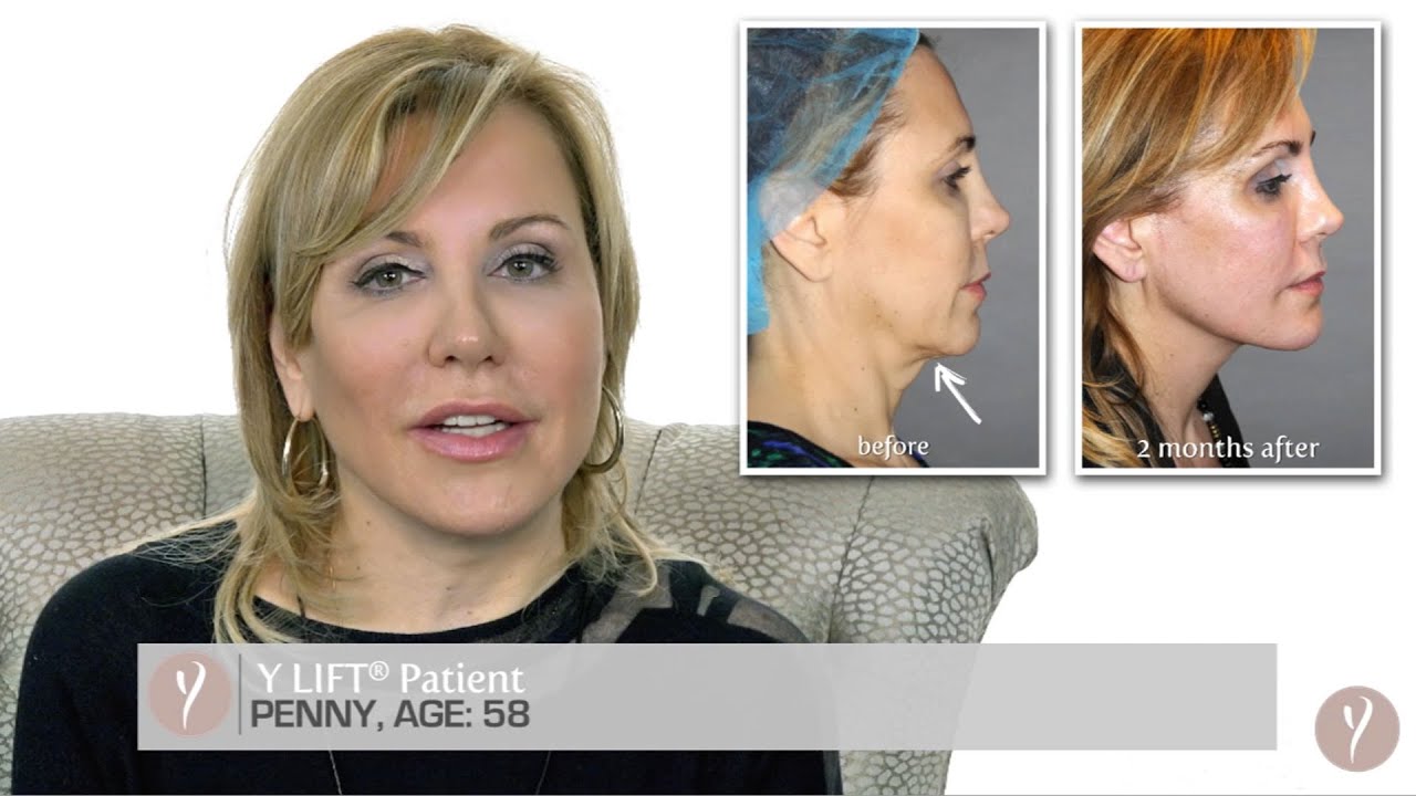 Y LIFT ® 2015 - Penny | Instant, Non Surgical Facelift - YouTube