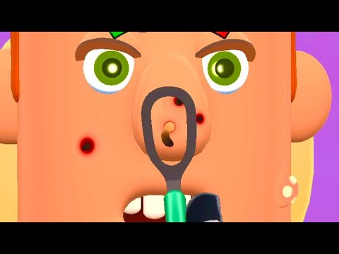 Pimple Popping 3D - Ios, Android Gameplay - YouTube