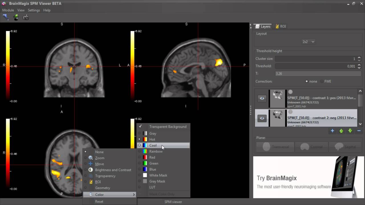 BrainMagix SPM Viewer: Demo - YouTube