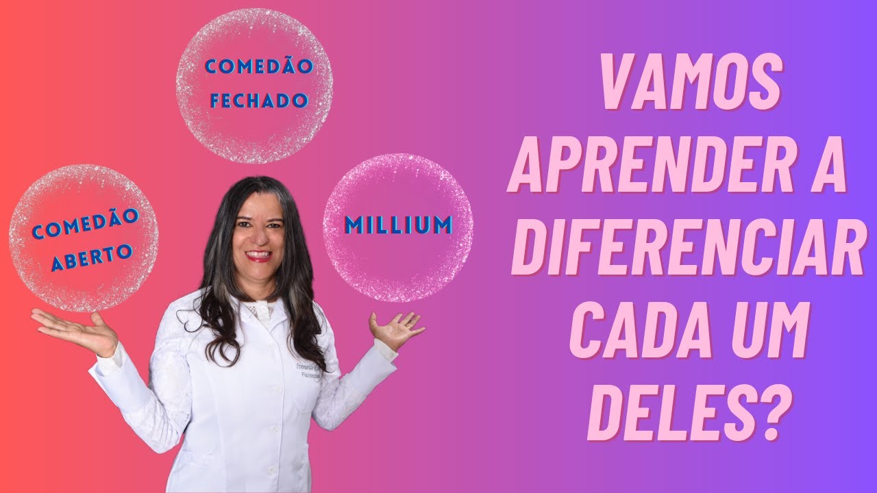 COMEDÃO ABERTO, COMEDÃO FECHADO e MILLIUM. Vamos aprender a diferenciar ...