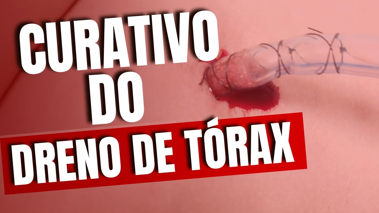 Curativo de Dreno: O SEGREDO para evitar infecções e complicações ...