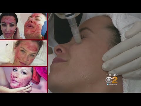 Young Blood: Using A Teen's Blood To Reverse Aging