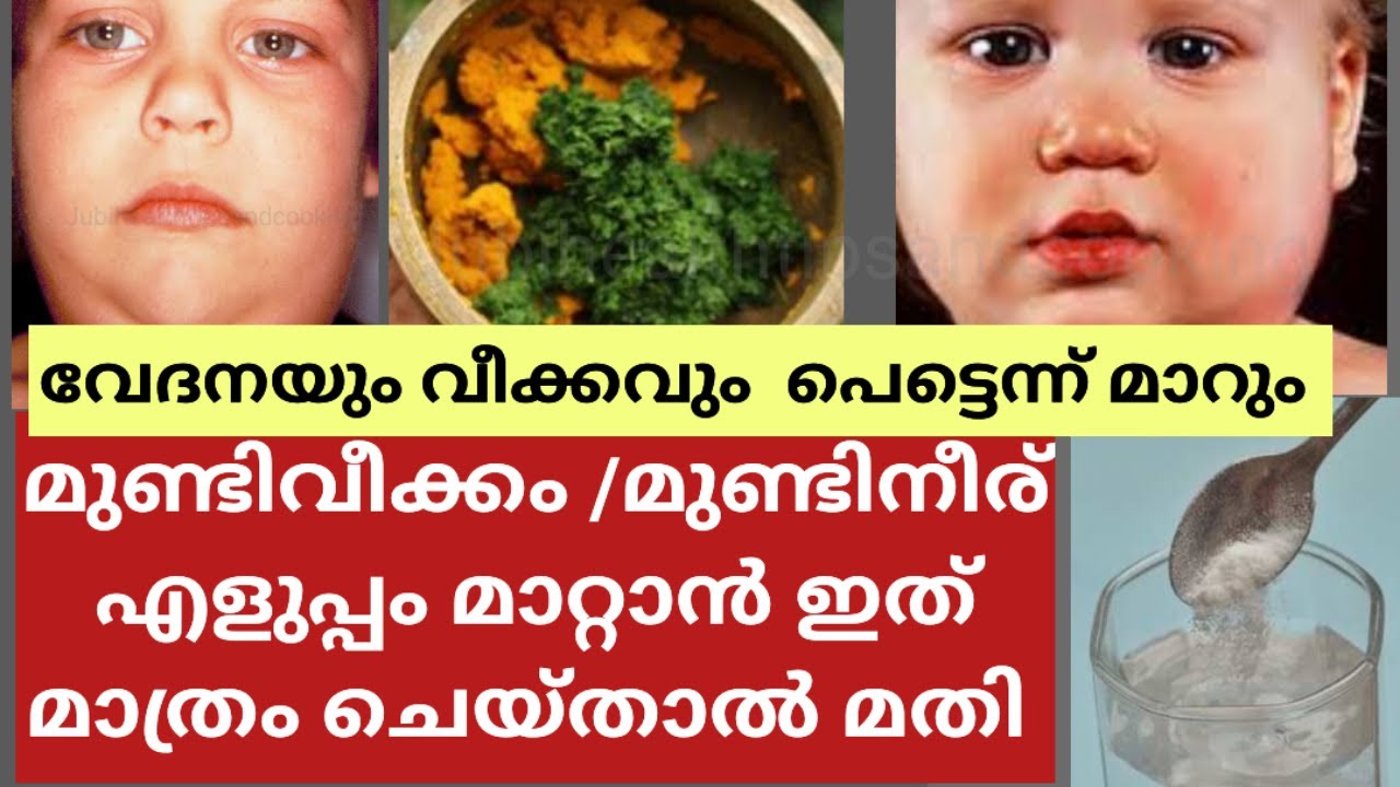 Mundi veekam malayalam home remedies | മുണ്ടി വീക്കം വേദനയും നീരും ...